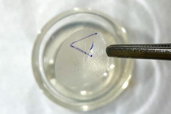 Amniotic membrane in optometry practice for dry eye patients? - nzoptics