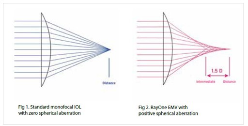 RayOne EMV IOLs launched in NZ - nzoptics